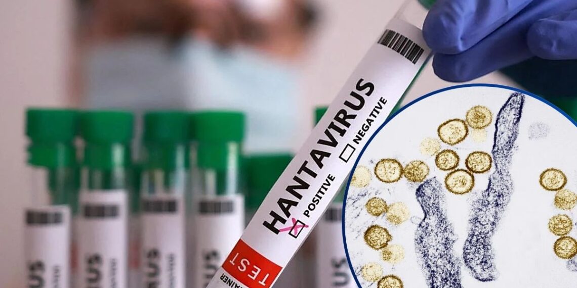 ¡Descartan mutación del hantavirus del crucero! Pertenece a la ...
